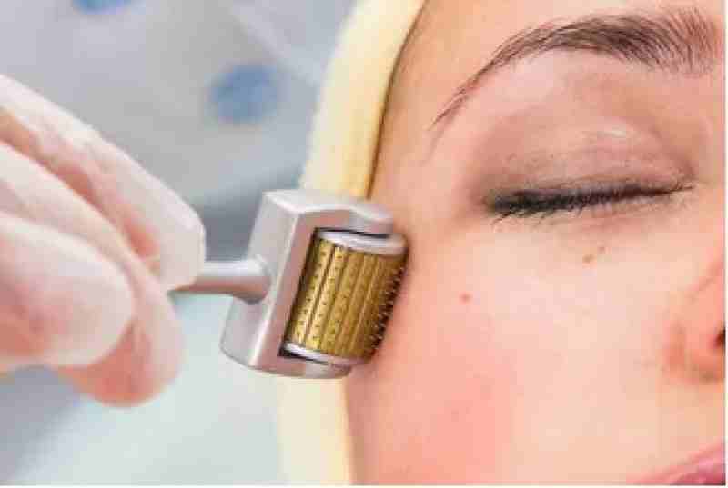 The Ultimate Guide to Dermal Fillers: Everything You Need to Know
